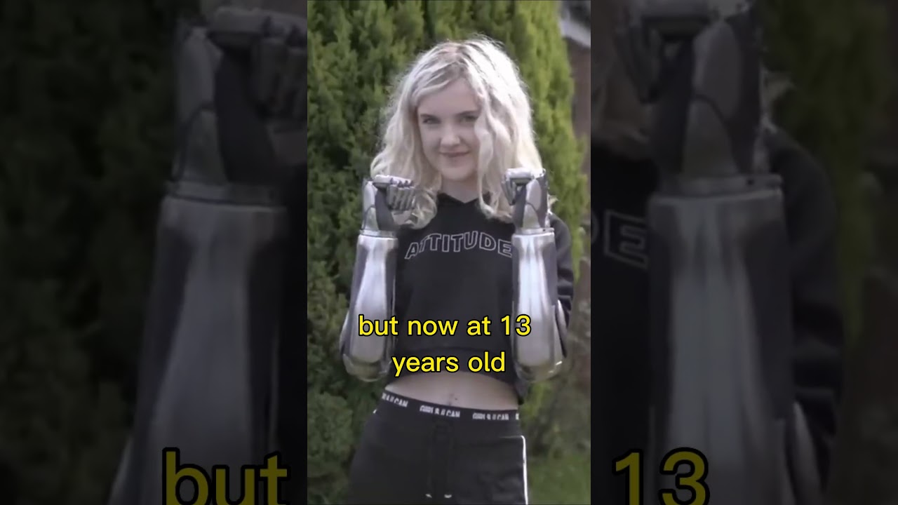 AI Robot Arms: One Step Closer To Cyborgs?