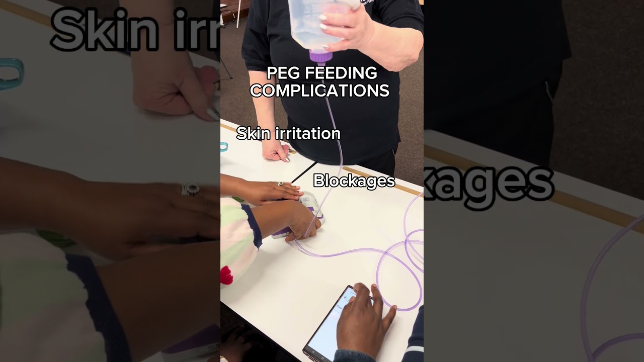 PEG feeding complications 🔔