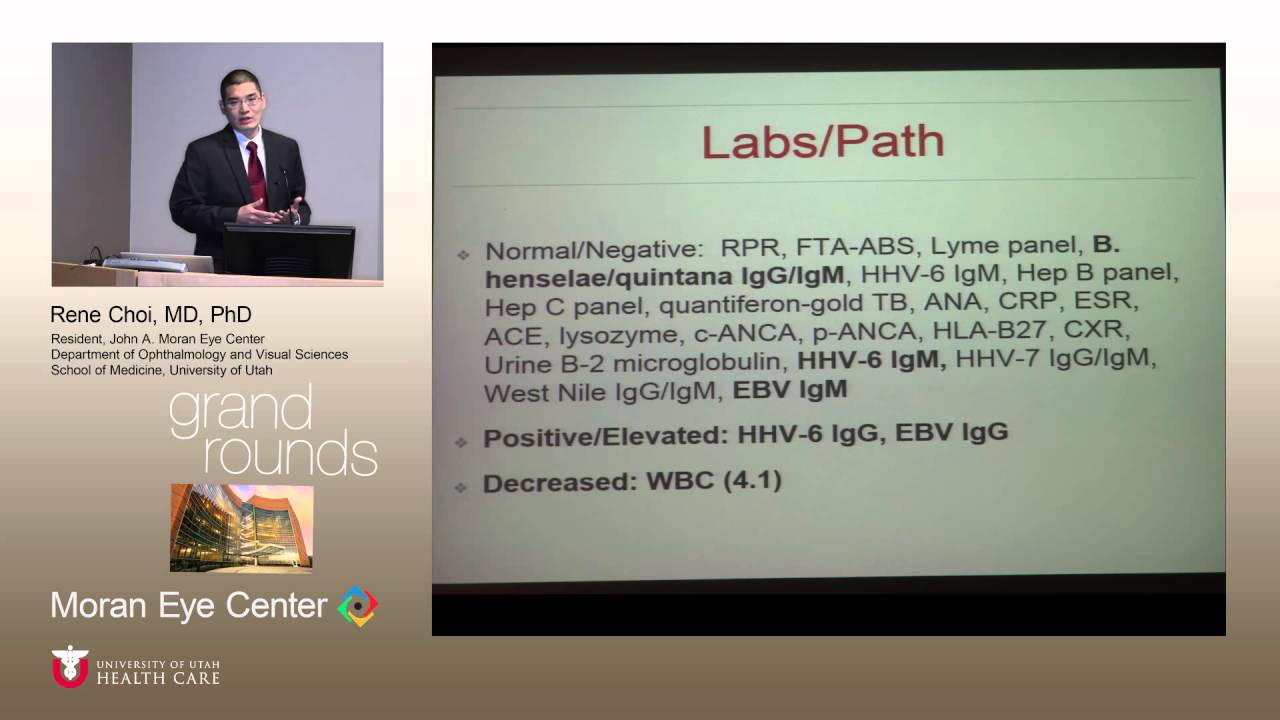 Uveitis - Pediatric Patient [ARCHIVE]