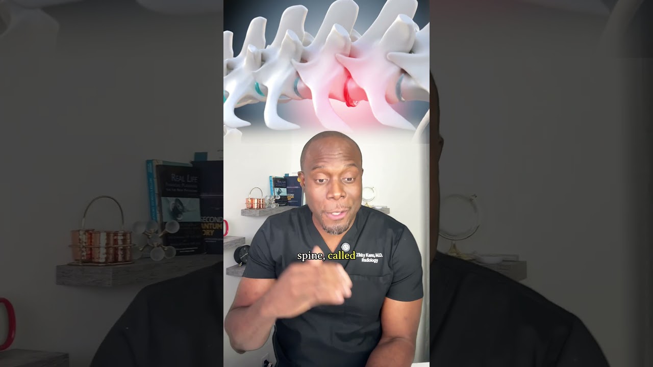 How Do X-Rays Spot Osteoporosis?