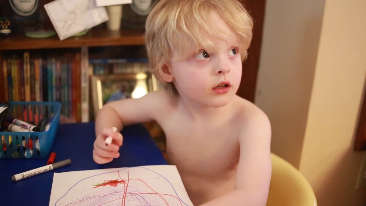 Vision Therapy Success Story- Amblyopia