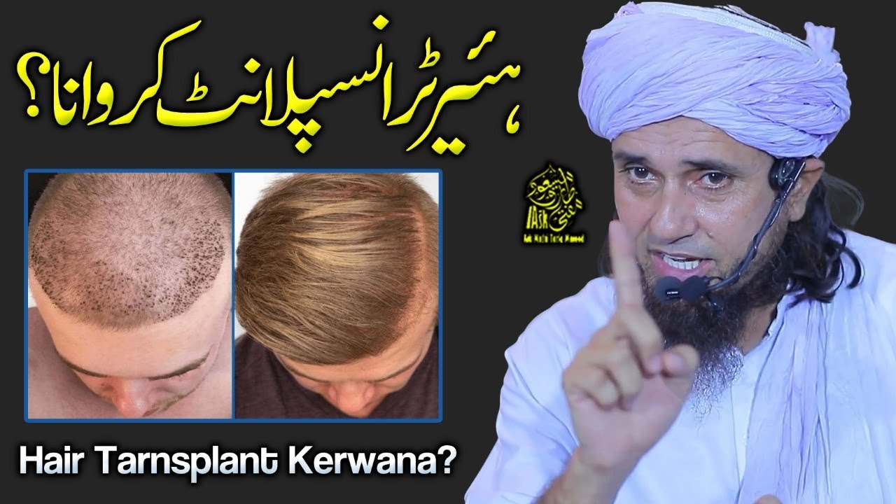 Hair Transplant Karwana | Ask Mufti Tariq Masood