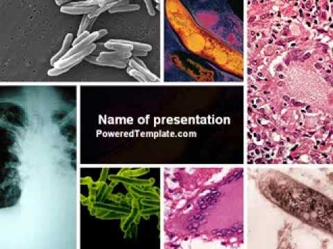 Tuberculosis PowerPoint Template by PoweredTemplate.com