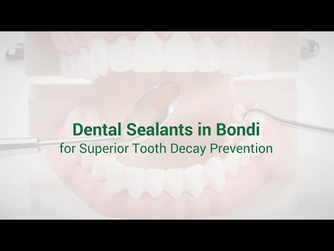 Dental Sealants in Bondi for Superior Tooth Decay Prevention