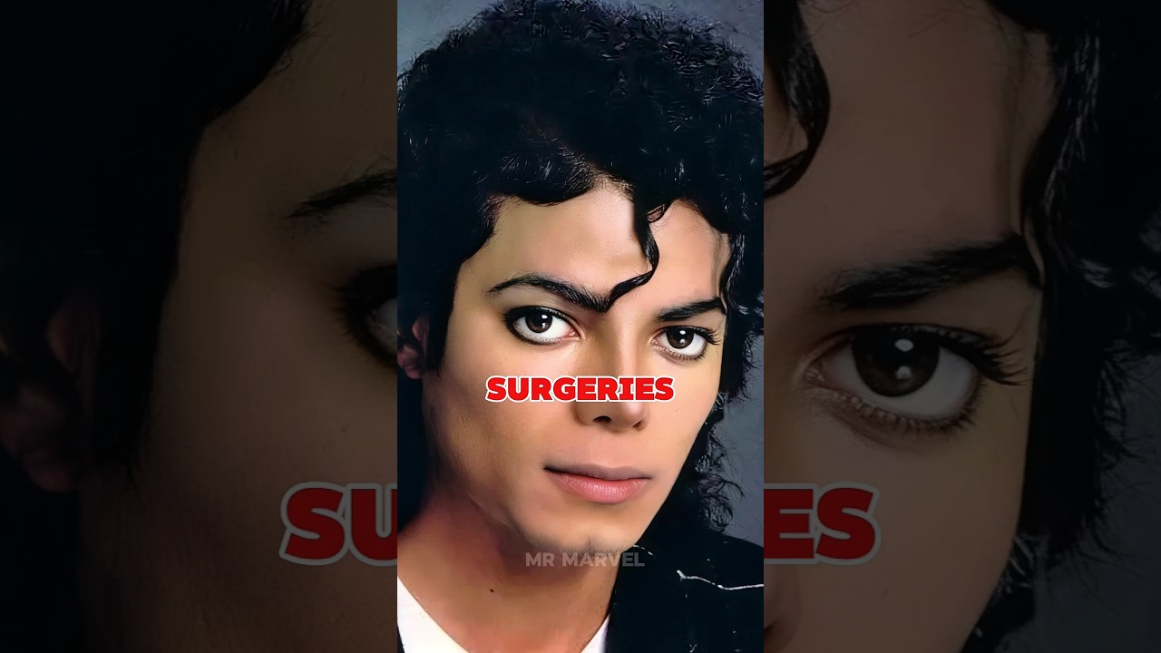 Michael Jackson Owned Over 50 Plastic Surgeries But Denied..