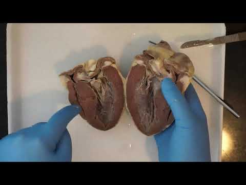 Heart Dissection