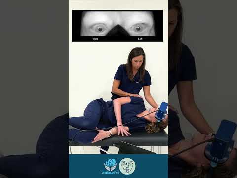 Side lying test for posterior canal BPPV (left side tested here) #vestibularrehabilitation #bppv