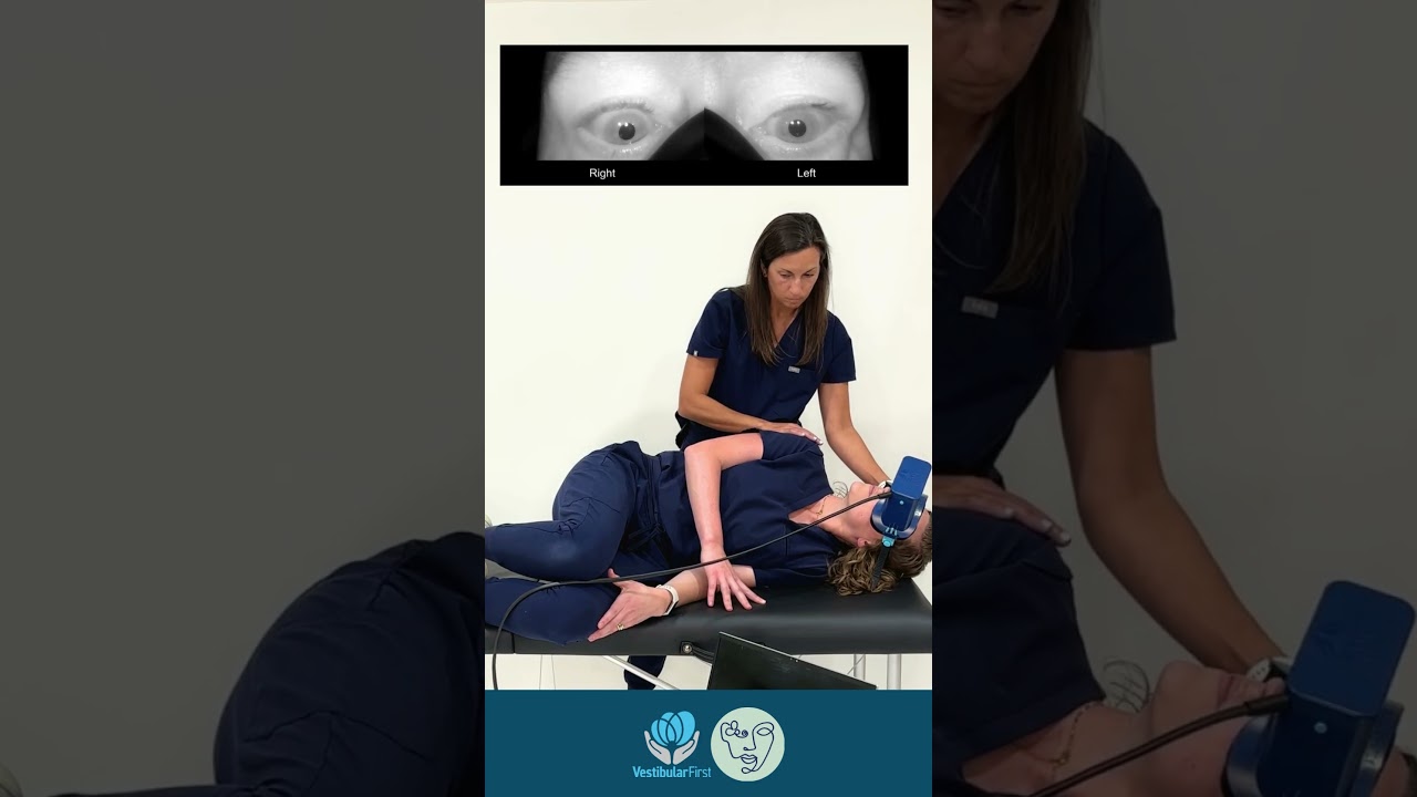 Side lying test for posterior canal BPPV (left side tested here) #vestibularrehabilitation #bppv