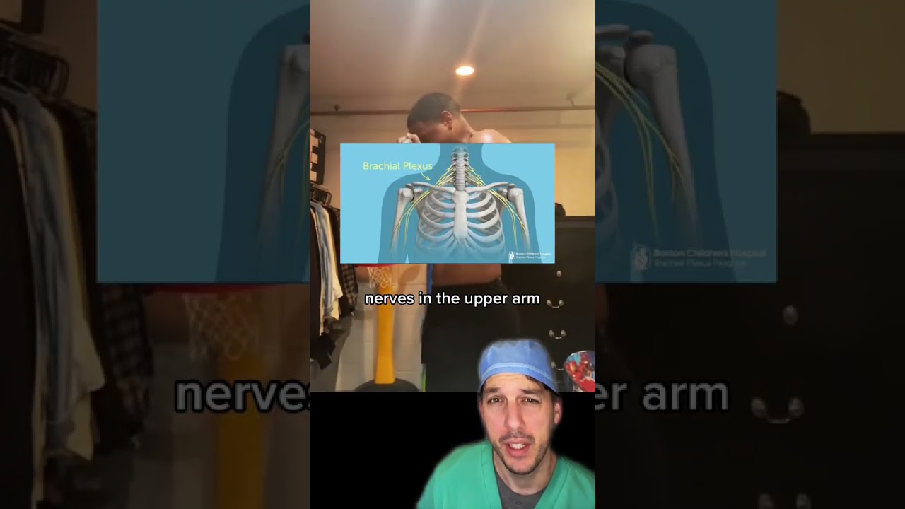 The result of a brachial plexus injury #Brachialplexus #Injury #NerveDamage #Nerve #atrophy#Dr#Nurse
