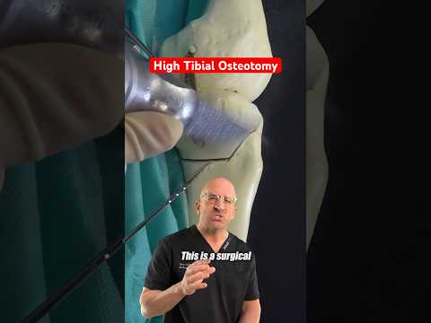 Knee Replacement Alternative for Young Active Arthritis Warriors #shorts