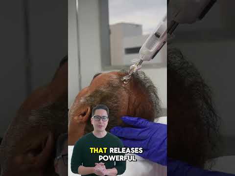 Stem Cells: The Future of Hair Regrowth? 🌱💇♂️