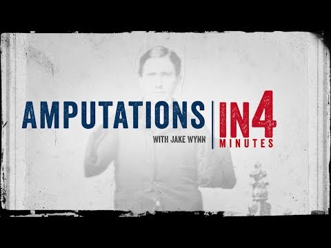 Amputations: The Civil War in Four Minutes