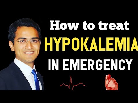 HYPOKALEMIA TREATMENT GUIDELINES, SYMPTOMS, MANAGEMENT, ECG CHANGES, POTTASSIUM REPLACEMENT PROTOCOL