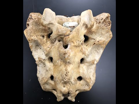 Anatomy of the Sacrum: Part Plus a Brief Overview of Spine-Related Nerves and Their Passageways.