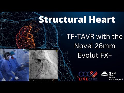 First Live Case in the World of TF-TAVR with the Novel 26mm Evolut FX+