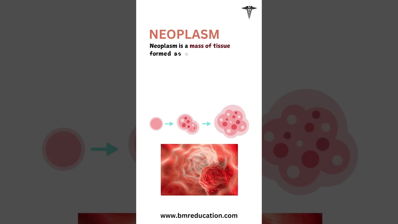 Neoplasia Explained | General Pathology 2025 | What is Neoplasia & Neoplasm?