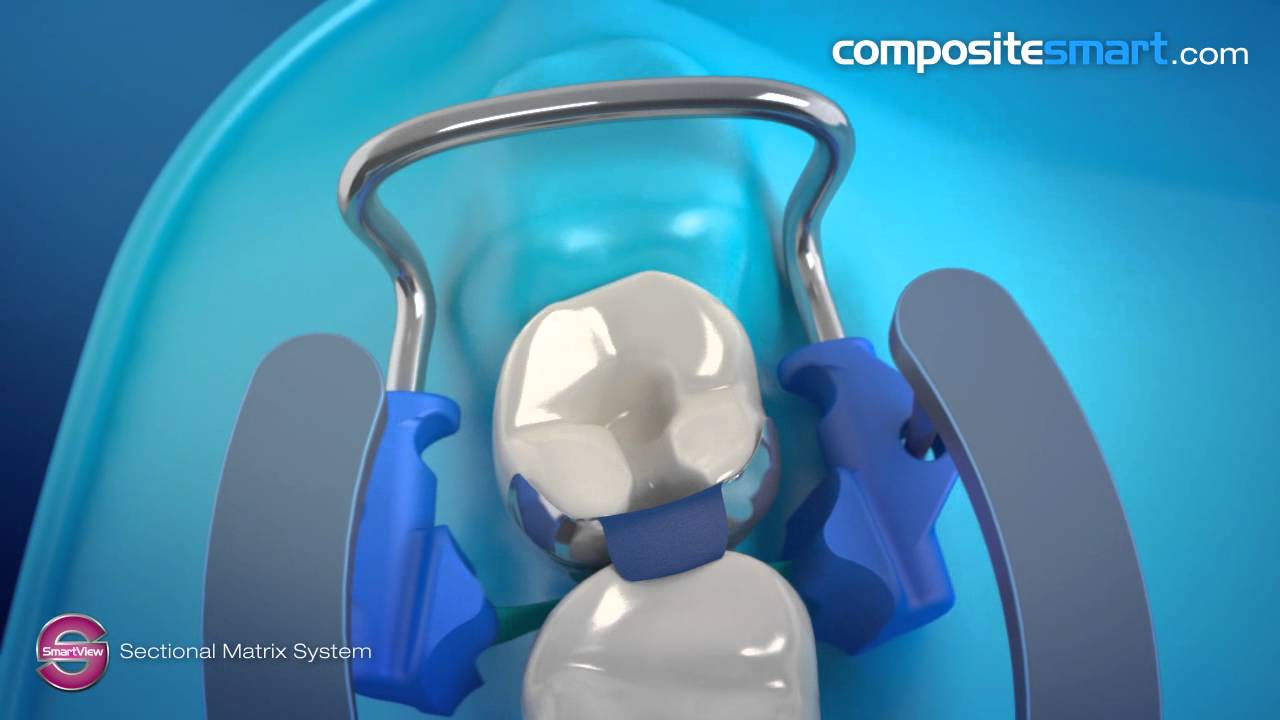 SmartView Sectional Matrix System - by CompositeSmart