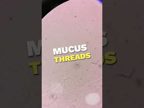 Mucus threads in urine under the microscope #laboratory #microscope #mls #cls #medtechstudent