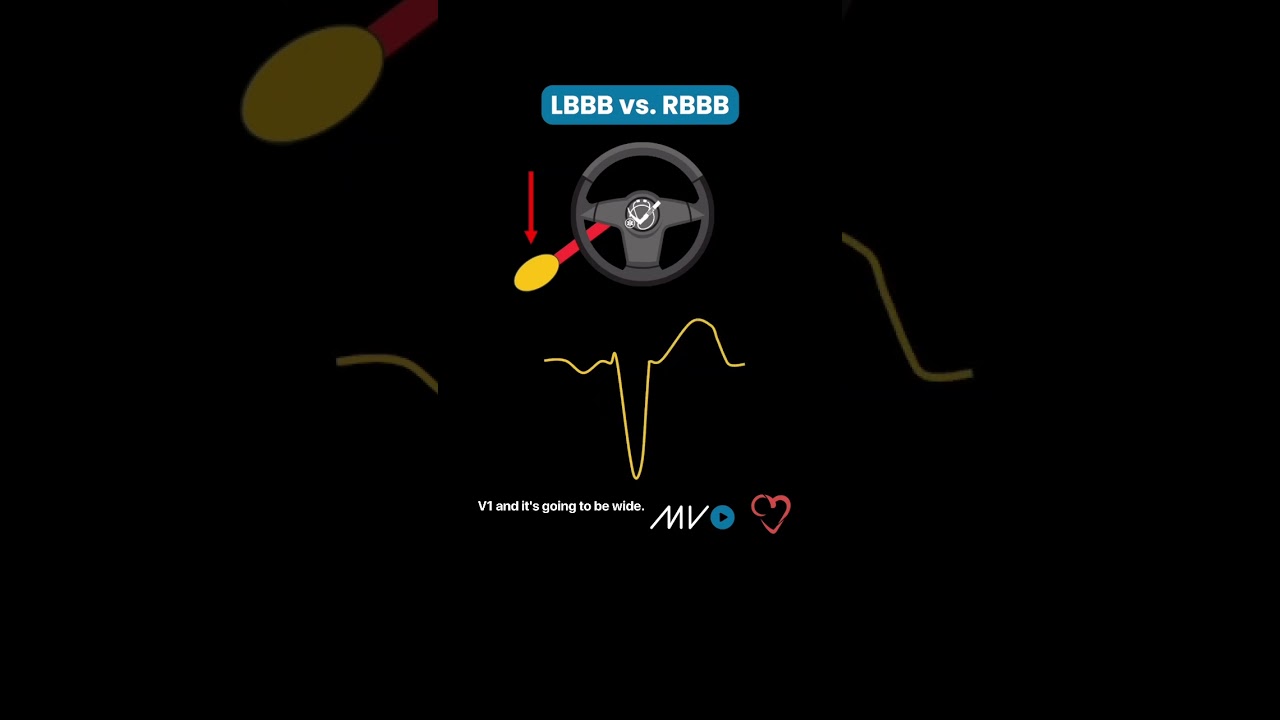 LBBB vs. RBBB Made Easy! 🫀
