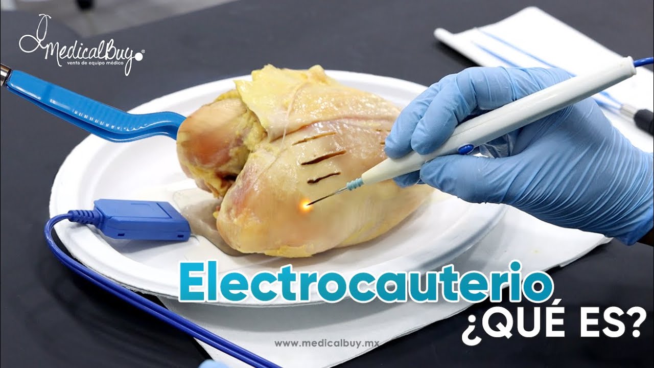 ¿Para qué sirve un Electrocauterio?