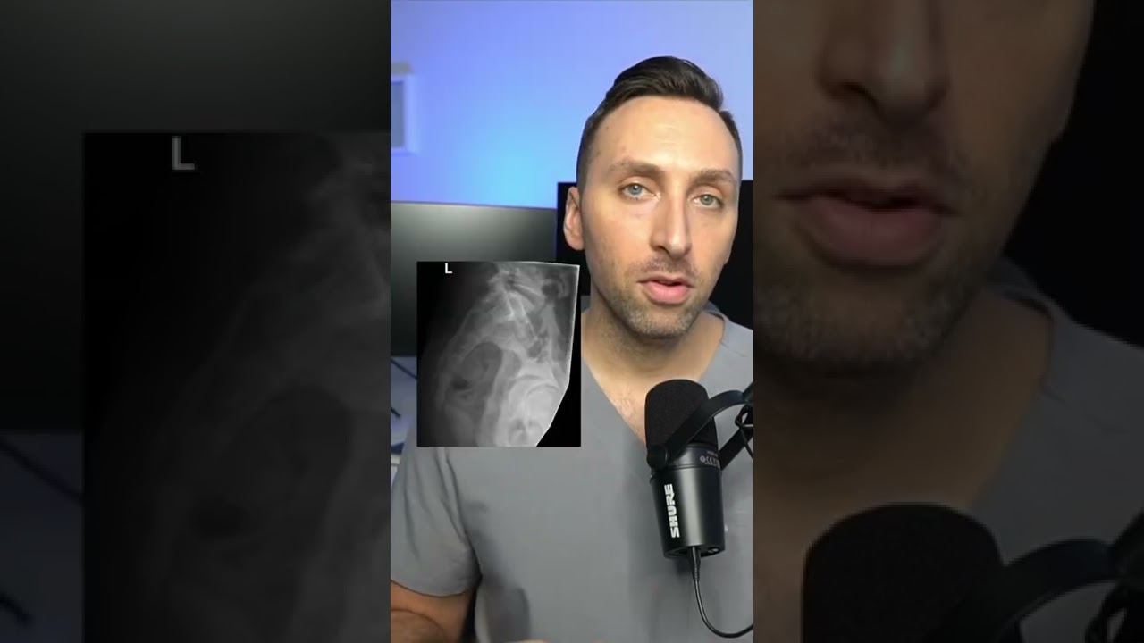 COCCYX X-RAYS - Why You Shouldn’t Order Them