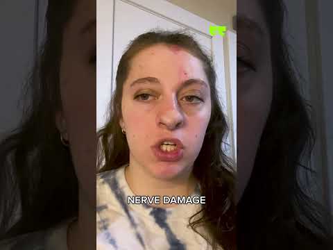 My Nose Was Bitten Off