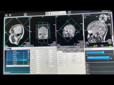 MRI BRAIN FULL PLANING & FILMING UNITED IMAGING MRI MACHINE