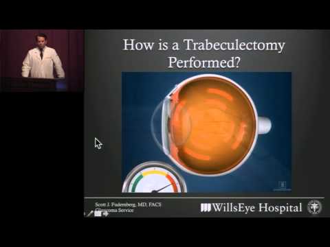 Trabeculectomy Surgery-Scott Fudemberg, MD-April 25, 2015 CARES Conference
