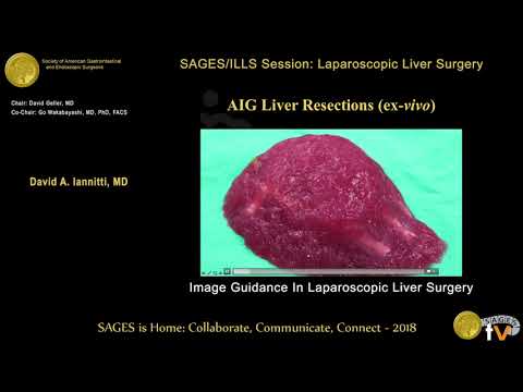 The role of advanced image guidance in liver surgery