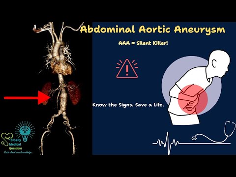 Abdominal Aortic Aneurysm AAA: Diagnosis, Risk Factors, Treatment explained : Clinical Tutorial