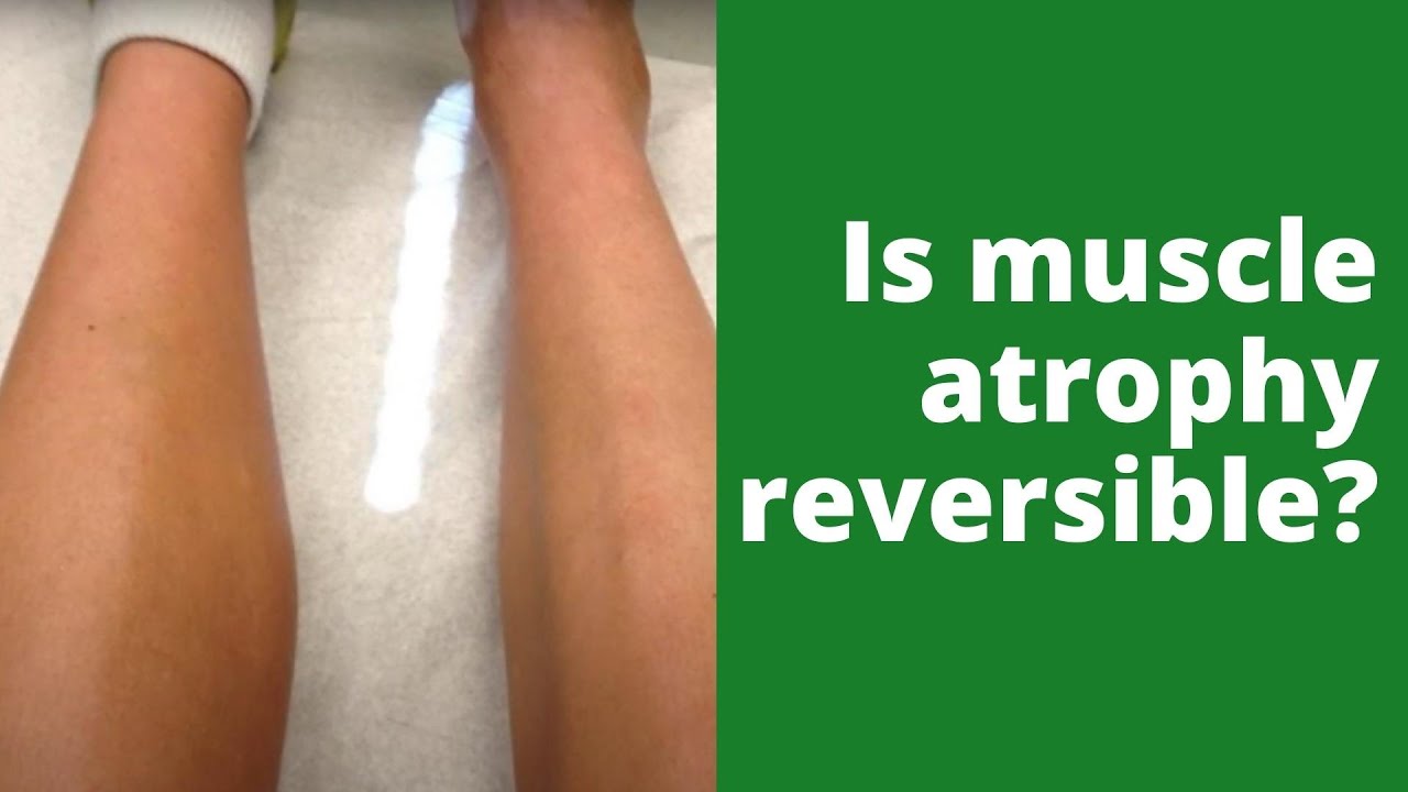 Is muscle atrophy reversible?
