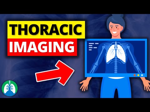 Thoracic Imaging (Overview) | Chest X-Ray | CT Scan | V/Q Scan | PET Scan
