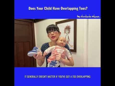 Does Your 👧Little One Have Overlapping Toes 👣