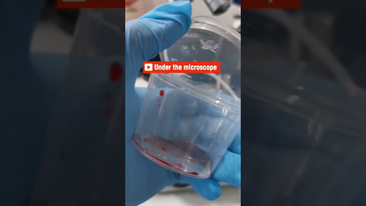 period blood under the microscope #laboratory #microscope #periodblood #bloodcells #menstrualblood