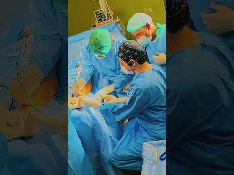 FROZEN SHOULDER ADHESIVE CAPSULITIS TREATED WITH KEY HOLE SURGERY l DR USAMA BIN SAEED l