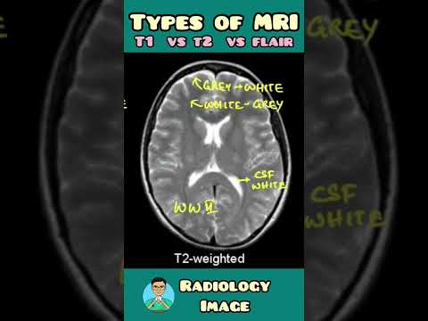 Types of MRI : T1 vs T2 vs Flair | Radiology | #shorts