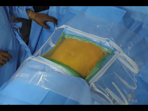 Adhesive Drapes - Adhesive Surgical Drapes Latest Price, Manufacturers ...