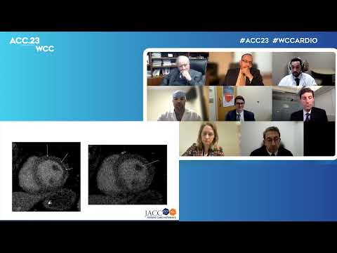 CVICU: CT Interpretation - JACC PCP | Cardiac Arrest After Stem Cell Transplant