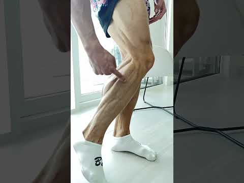 Calves - but it’s only skin