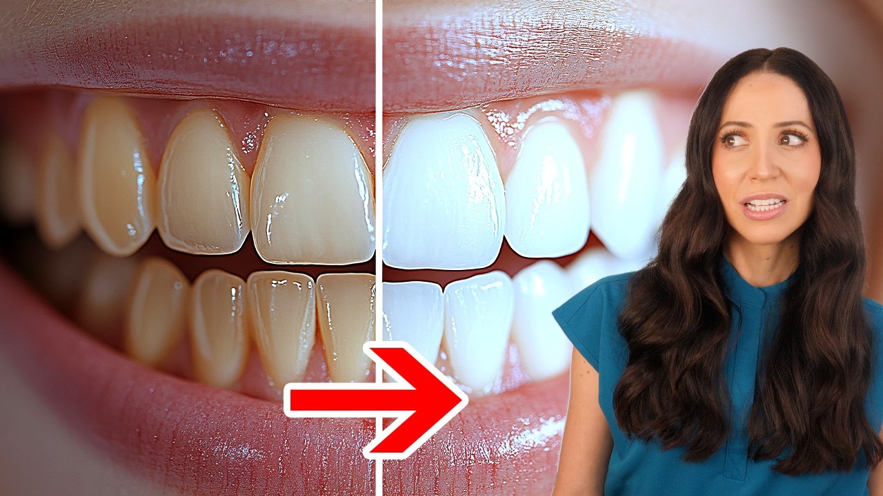 If You Have Stained Teeth… DO THIS!