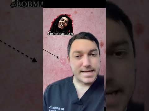 Talking about Clear Melanoma (Amelanotic Melanoma) - TikTok SkinDoc