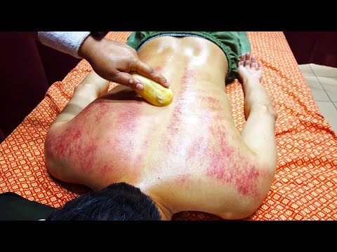 ASMR | Gua Sha "SKIN SCRAPING" Massage Therapy for Back Pain Relief