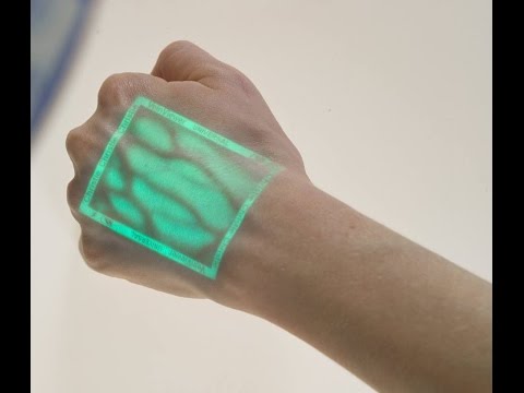 Vein Imaging Technology (Now in Egypt & Middle East)