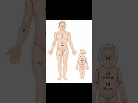 #BURN #WALLACE RULE OF NINE #medsurg #healthcare#nursing #dmer_maharashtra #aiims #gmch
