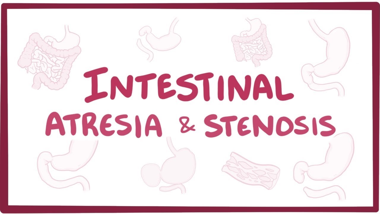 Intestinal atresia & stenosis - an Osmosis Preview