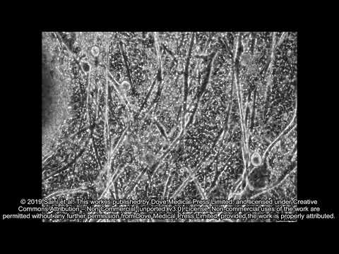 Novel coculture system to investigate NMJ formation and development – ID 187655