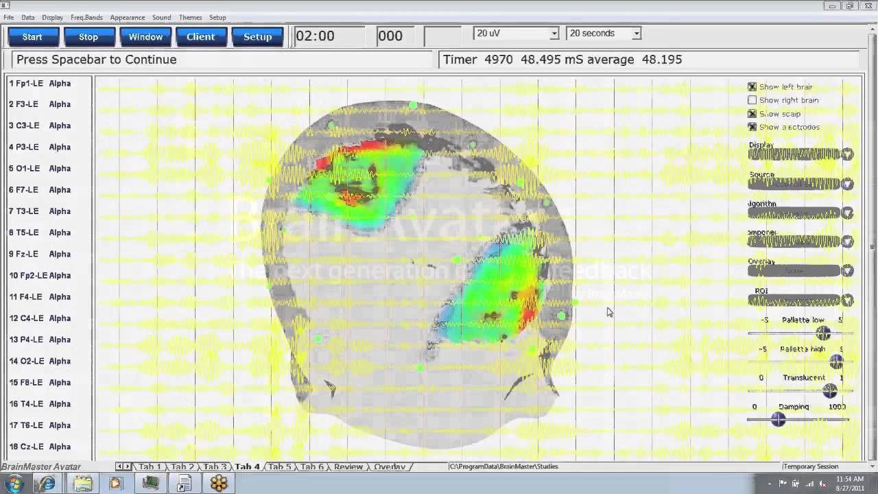 BrainAvatar by BrainMaster