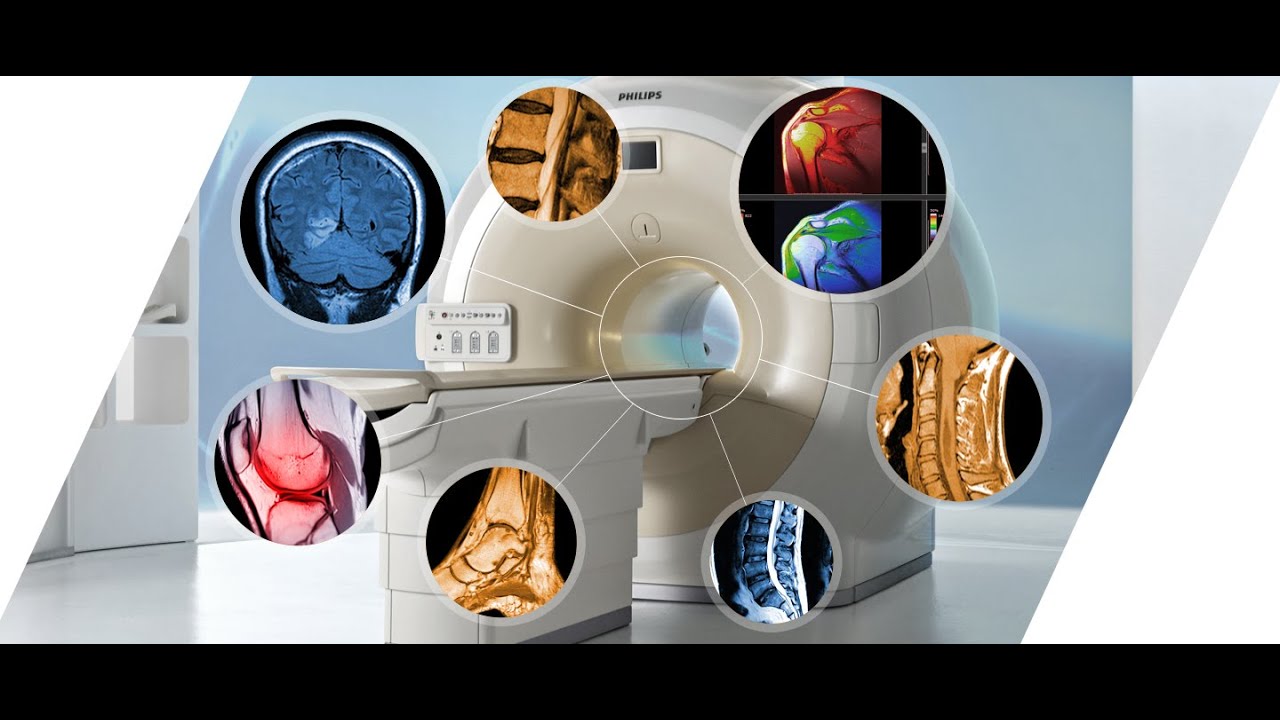 MRI for brain conditions