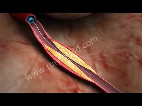 PCI Animation