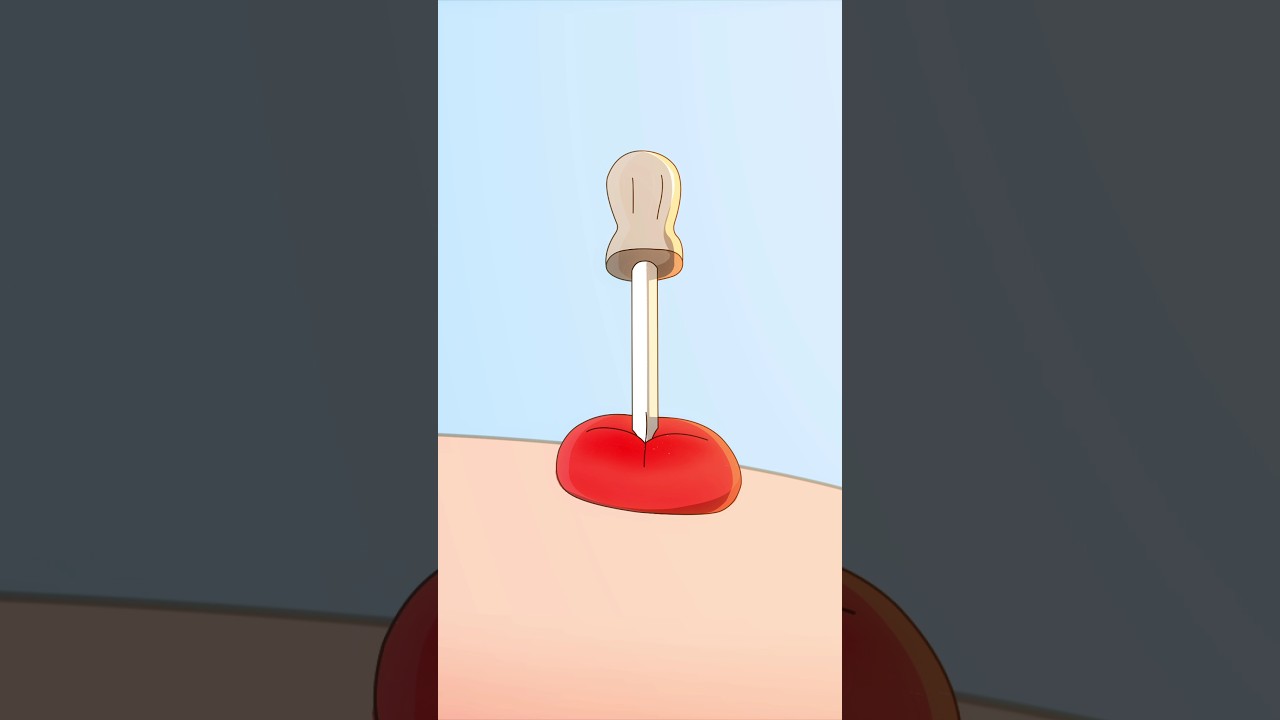 How to cure mosquito bite marks perfectly!